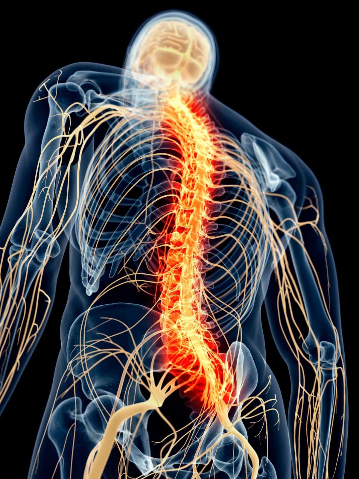 How to Overcome Back Pain and Spinal Stenosis with Experts